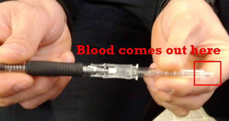 Glucometry: How to Do it